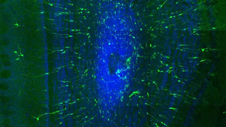 Wissenschaftler entdecken kritisches Gen für ein gesundes Gehirn