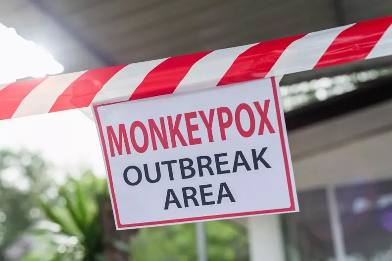 Monkeypox Outbreak Sign