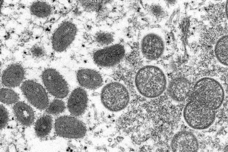 Monkeypox Poxviridae Virus