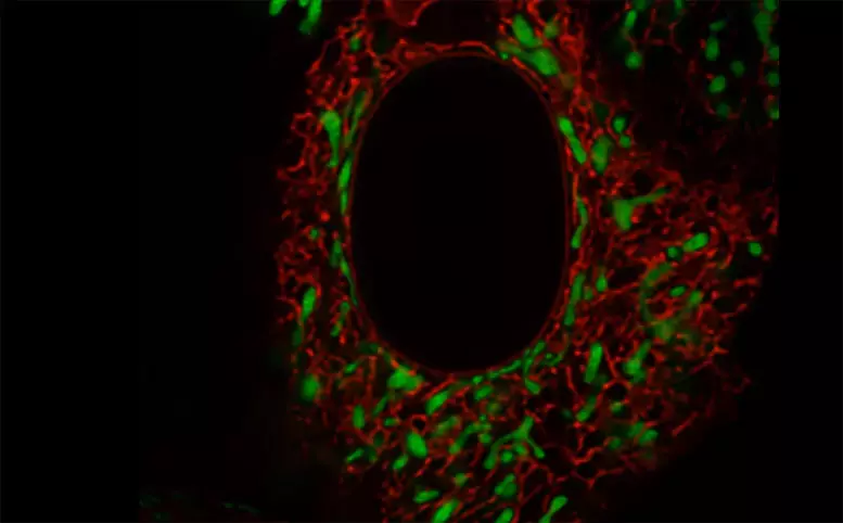 Doença renal intratável