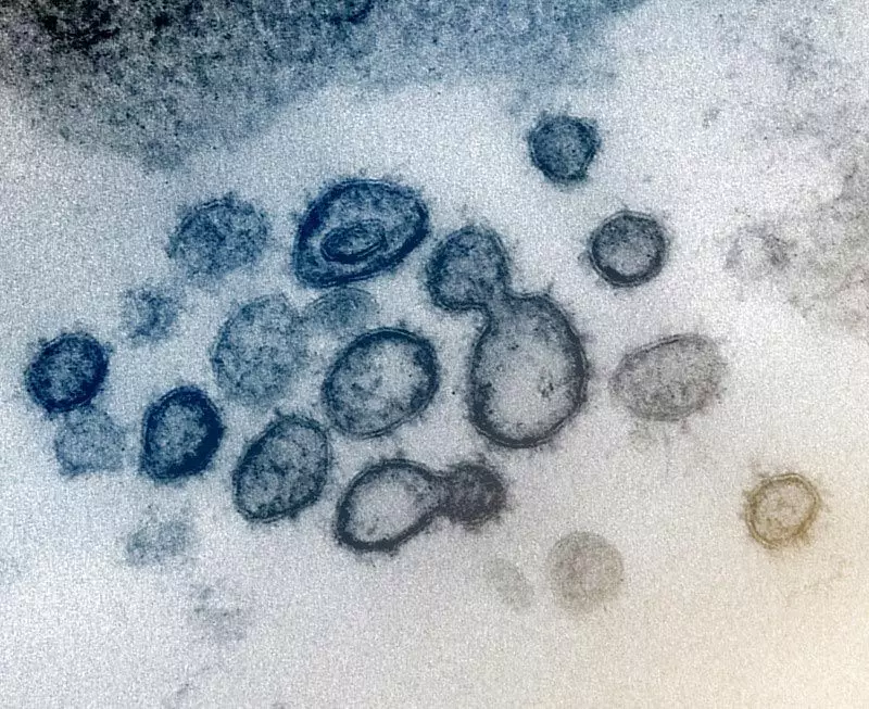 COVID-19: Silná připomínka výzvy vznikajících infekčních nemocí 10845_1