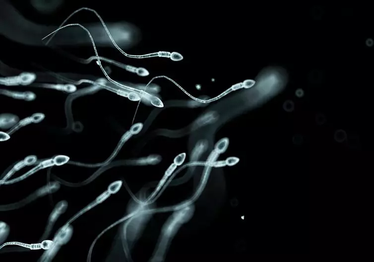 Human Sperm Human