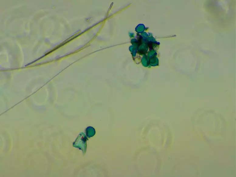 Ntau Pollen Grains nqa los ntawm Moth