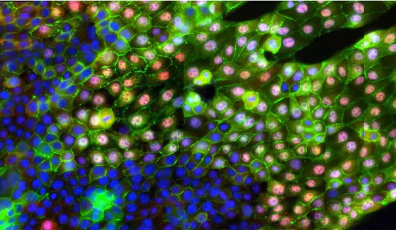 研究者は、癌がどのように広がるかについての分子の鍵を発見します