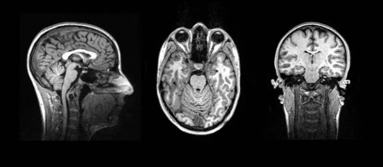 Dr. Rae Laboratory Brain Scan