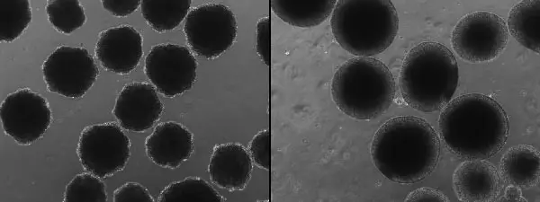 मस्तिष्क Organoids