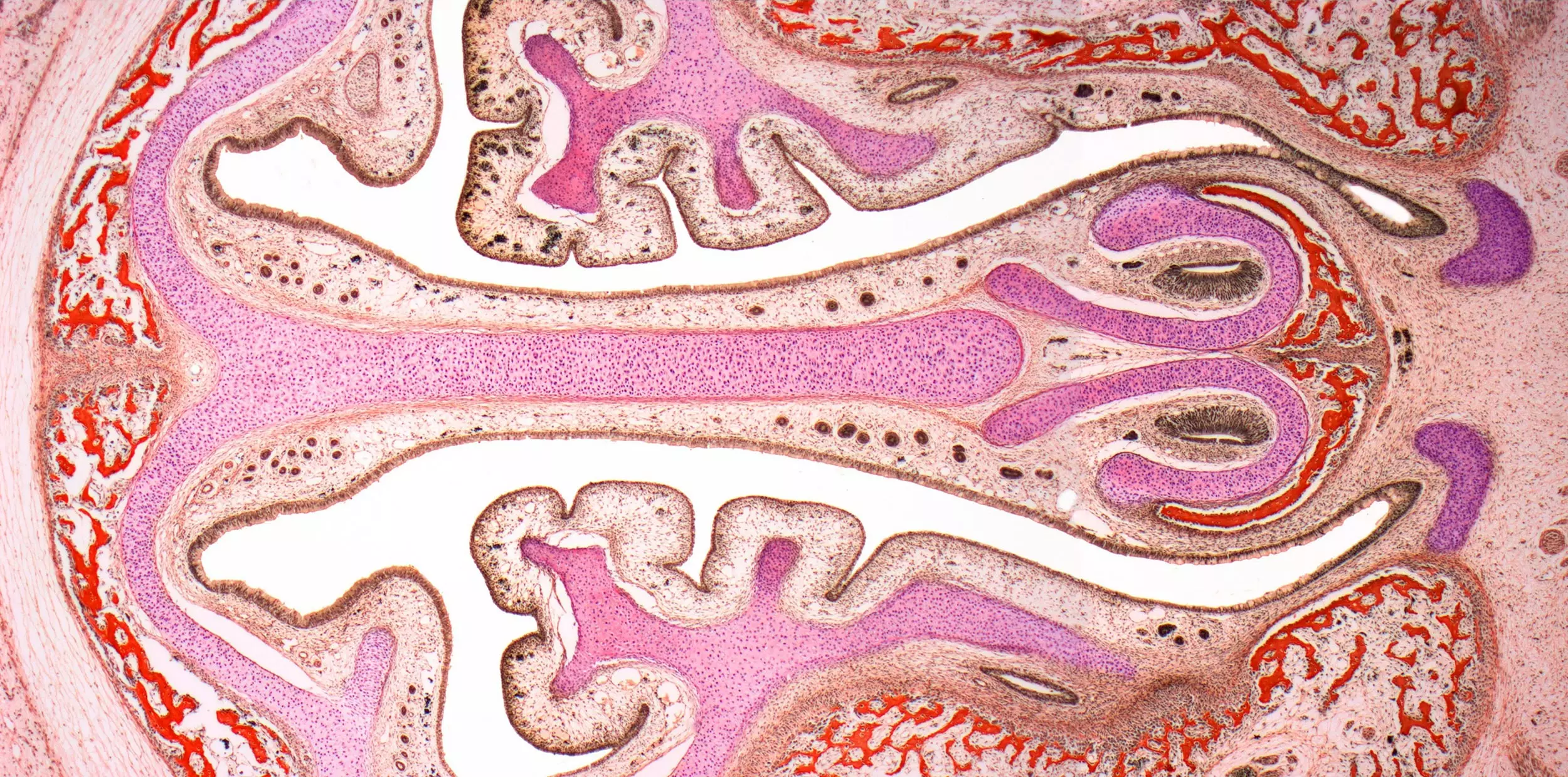 Abacwaningi Balandelela I-COVID-19 Infection Dynamics Ematheni Nasekhaleni