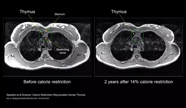 Thymus Calorie txwv