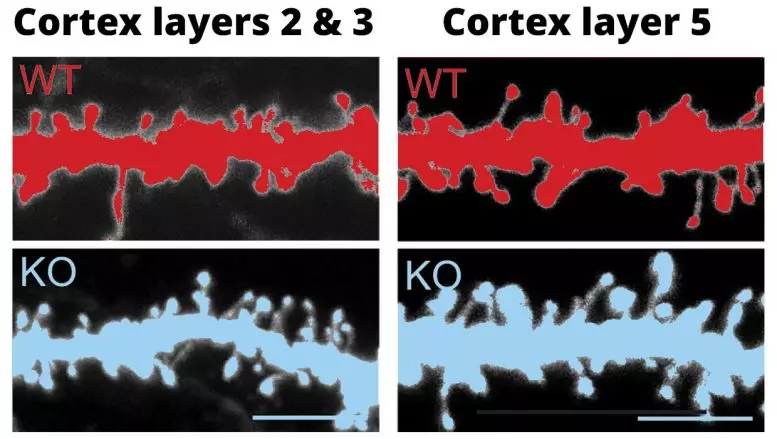 Garaacista FABP4 waxay beddeshaa Morfology ee Neurons Cortical