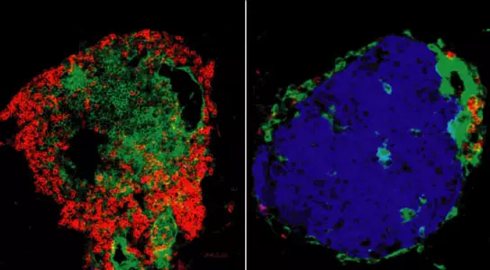 Ikke-nedbrydende antistoffer omvendt type 1-diabetes hos mus