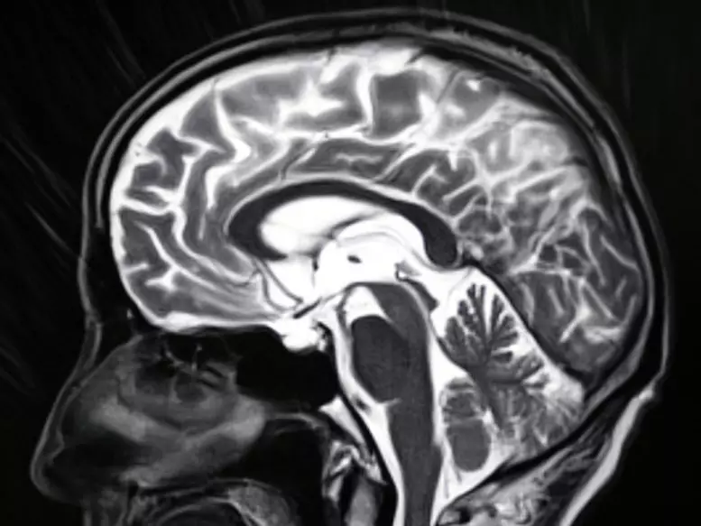 تصویر MRI مغز انسان