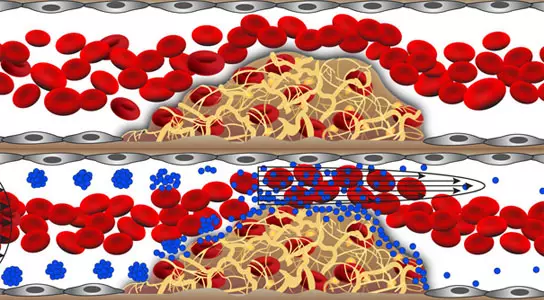 新しい生体模倣戦略は血栓を素早く溶解します