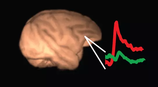 Svjesna percepcija iz globalne mreže neurona