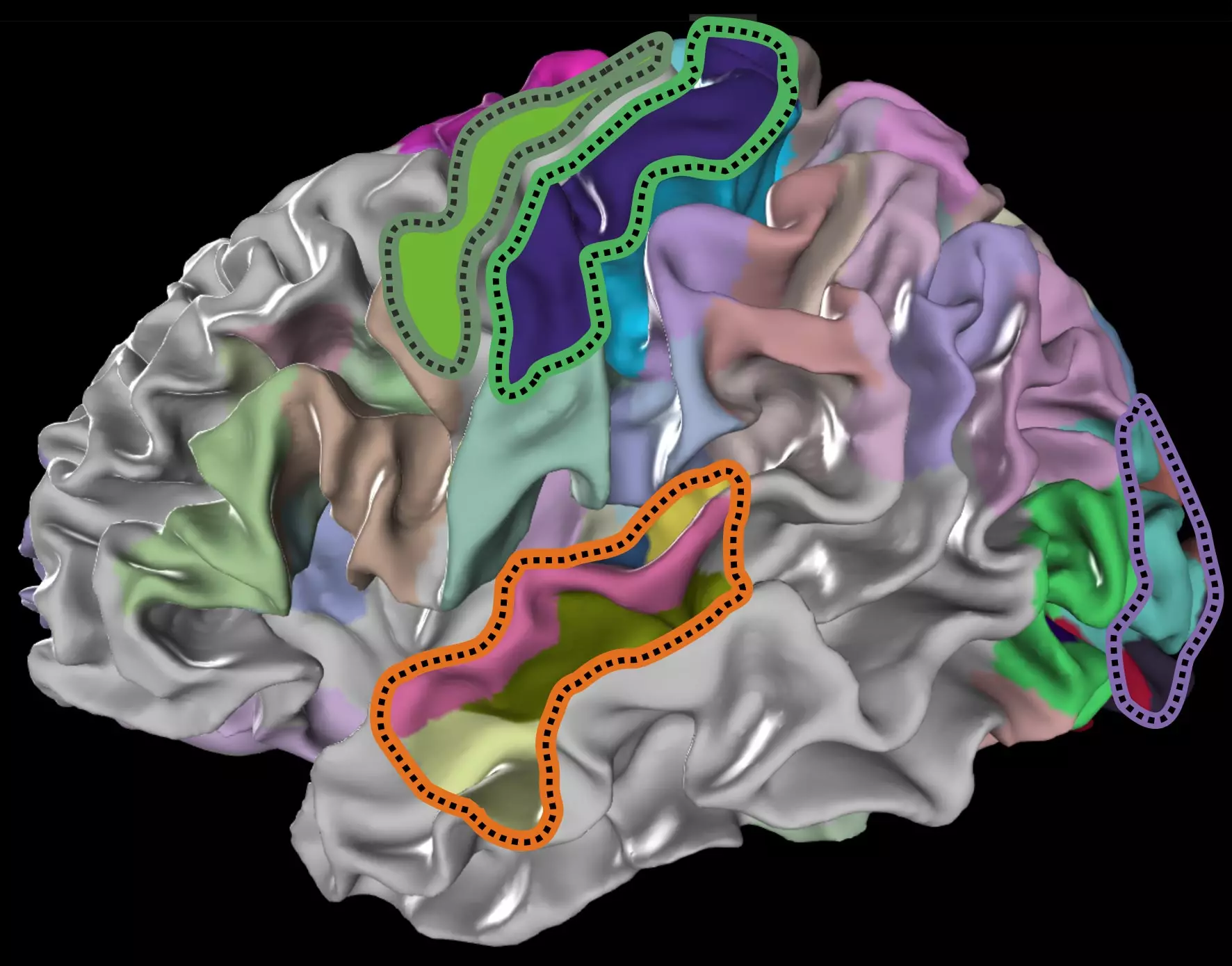 Έργο ανθρώπινου εγκεφάλου: Οι επιστήμονες ρίχνουν νέο φως στην οργάνωση του ανθρώπινου εγκεφάλου