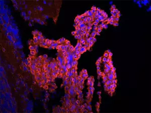 A2A Adenosine Receptor E ka ba Senotlolo sa Kalafo ea Multiple Sclerosis