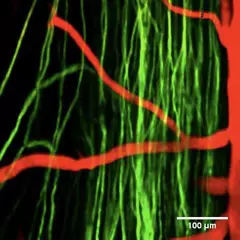 Imaxes da medula espiñal