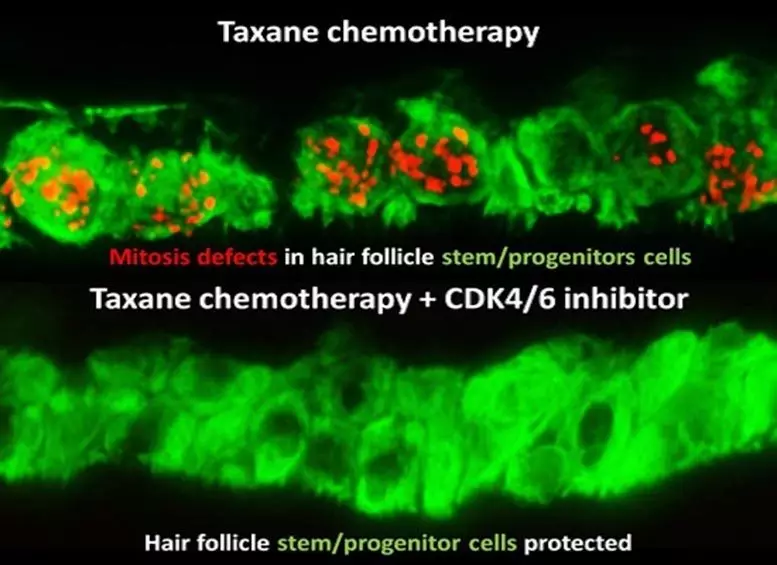 Taxane เคมีบำบัด CDK46 Inhibitor