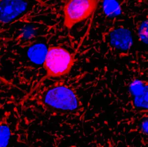 Le déséquilibre entre l'excitation et l'inhibition neuronales peut expliquer la sensibilité aux crises dans le syndrome d'Angelman