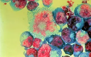 HIV-infizierte T-Zellen