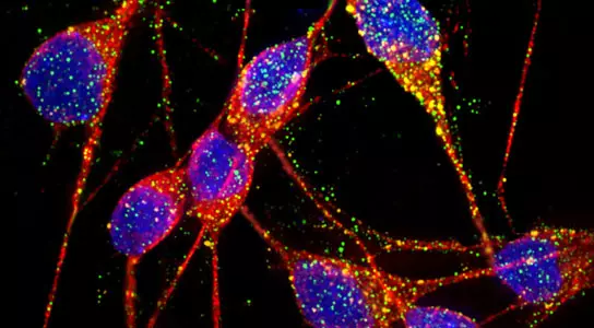 Els científics creen neurones derivades de cèl·lules mare a partir de la malaltia d'Alzheimer