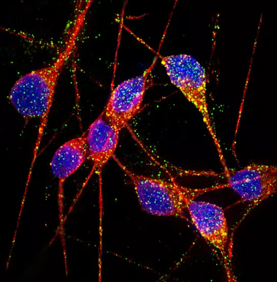 UC San Diego-forskere lager stamcelleavledede nevroner fra Alzheimers sykdom