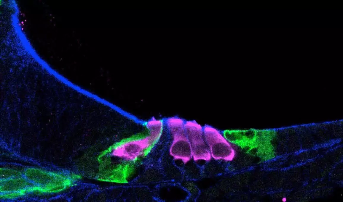 Su'e Laulu Fa'alogo Fa'ato'a Fanau Iole Cochlea