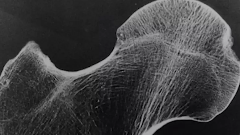 L'imaging a raggi X analizza la struttura ossea