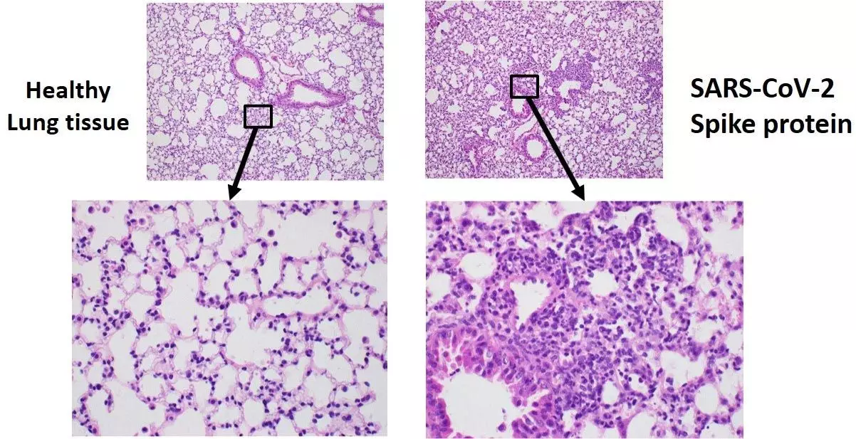 Jaringan Paru-paru lan Protein Spike SARS-CoV-2