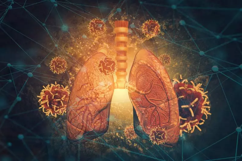 Concepto de atlas de enfermidades pulmonares