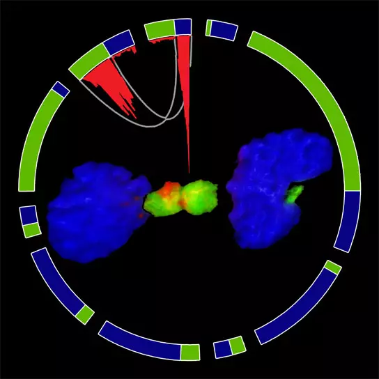 Une nouvelle recherche pourrait mener à un nouveau traitement pour un type de cancer du cerveau