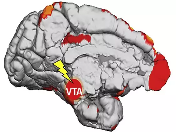 Ventral Tegmental Area