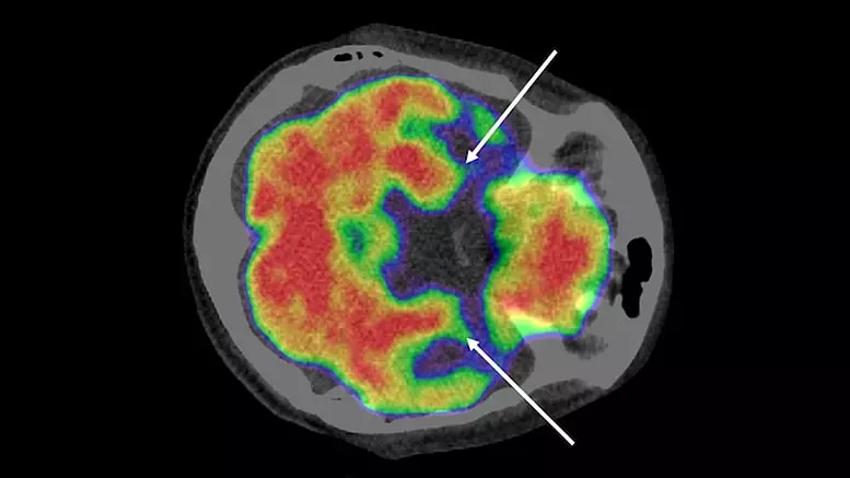 Cerebro estresado vinculado a corazón roto