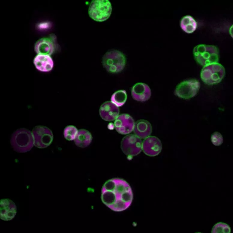 Пероксисома Intralumenal Vesicles