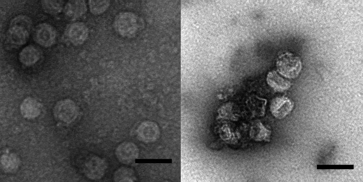 Standardna tehnika obrade vode uklanja i deaktivira omotani virus