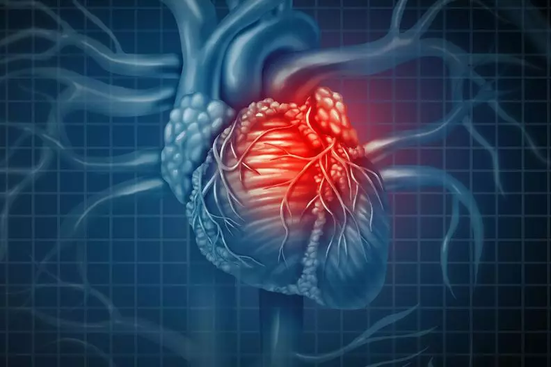 Koncepcja choroby serca