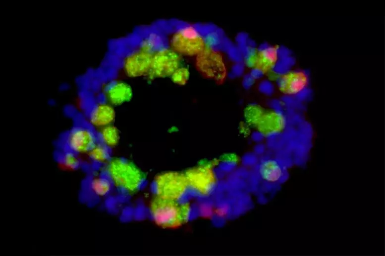 Gut Organoids