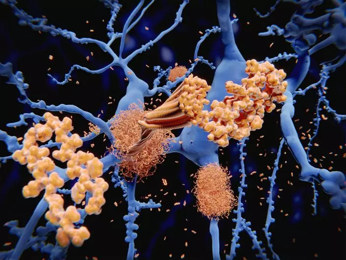 Amyloïedproteïenklonte langs neurone