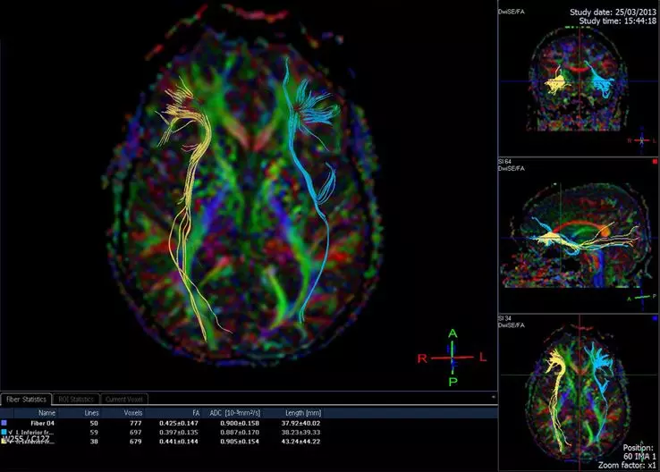 Concetto di neuroscienza di scansione cerebrale