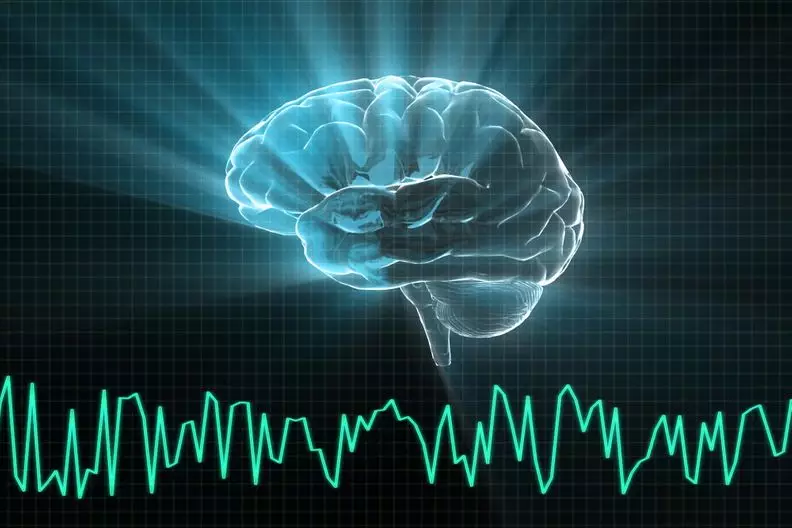 Brain Wave Graph