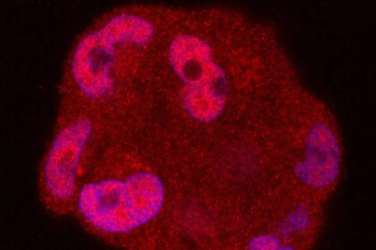 Molekul RNA Nu Suppresses Tumor Prostat