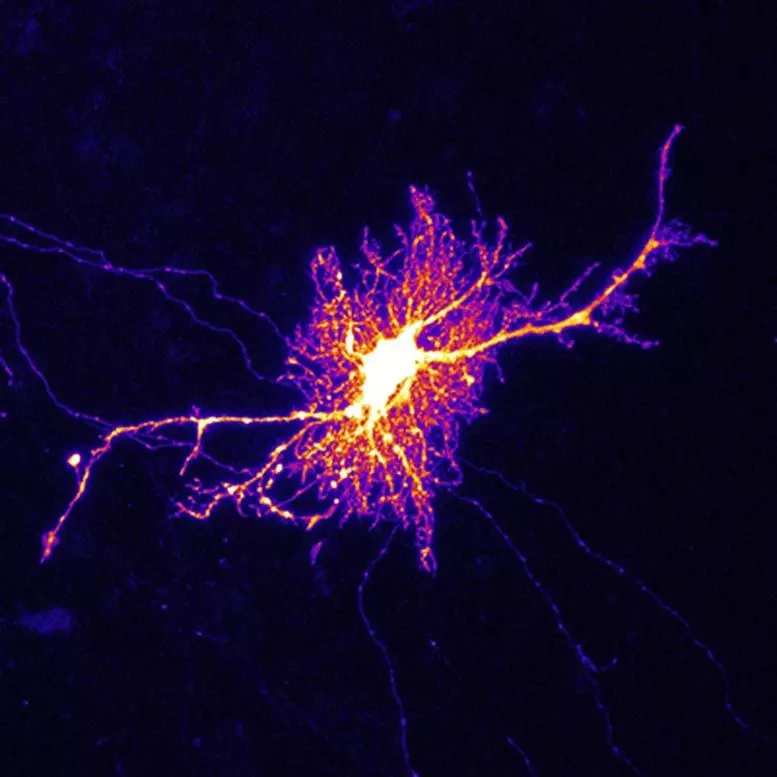 Astrocyte mikrograaf