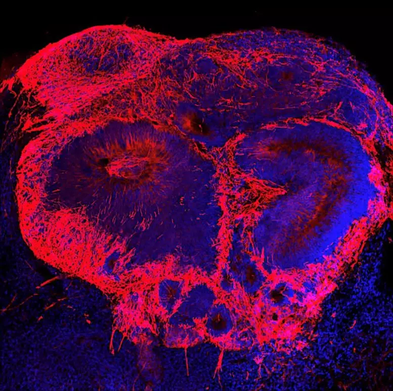 Schizophrenie Gehir Organoid