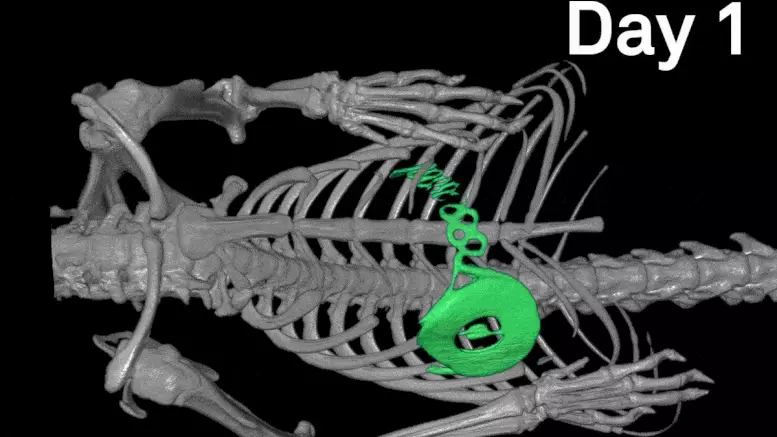 حل ڪرڻ Pacemaker MicroCT