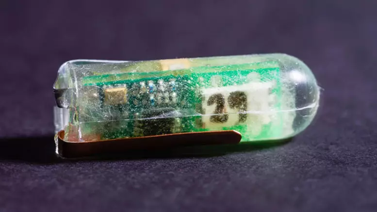 MIT-Ingenieure nutzen Magensäure, um winzige Sensoren mit Strom zu versorgen