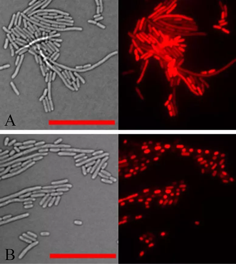 Mikroskopbilder av E. coli exponerad för antibakteriellt protein