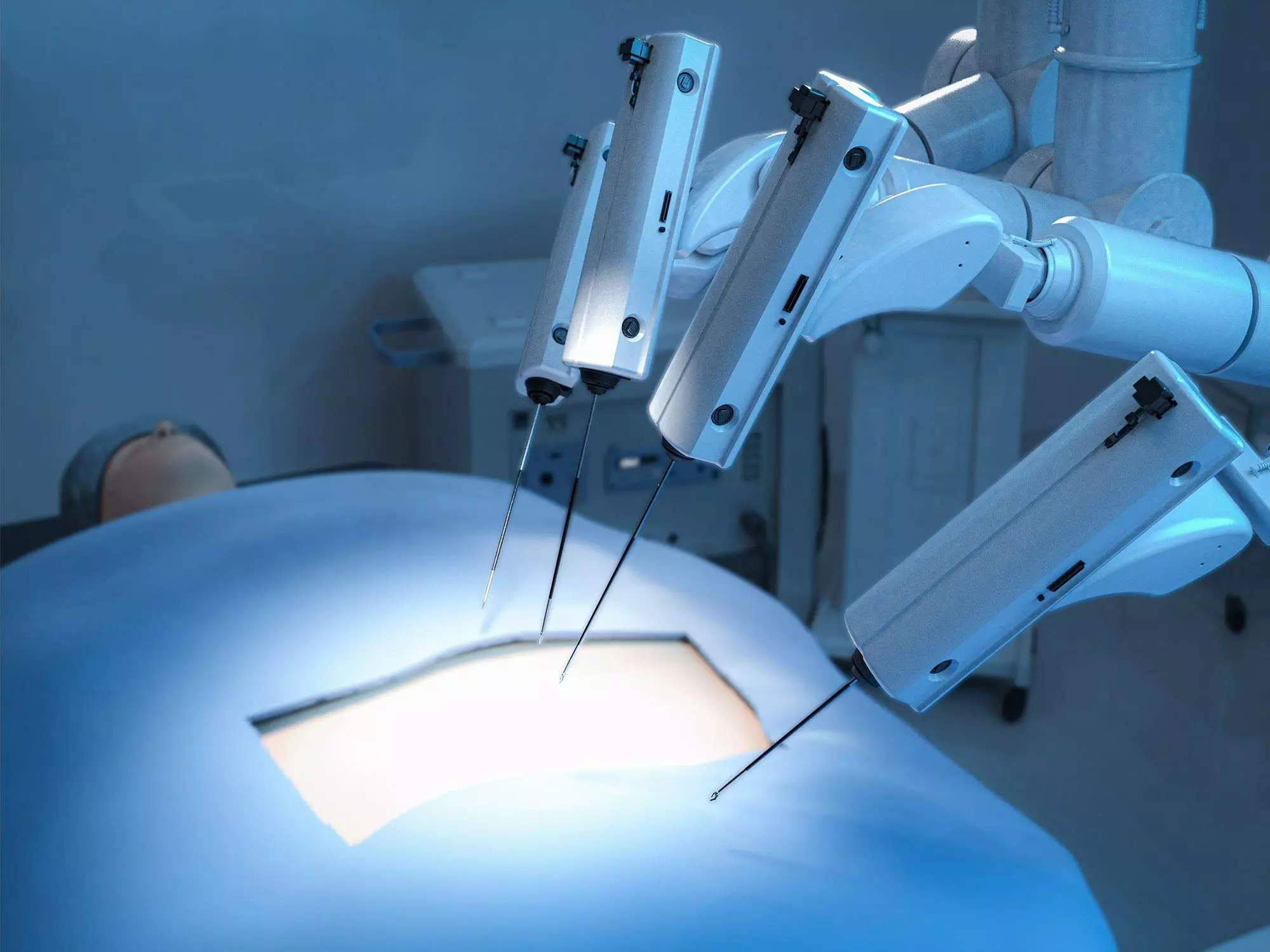 Исследования показывают, что роботизированная хирургия безопаснее и сокращает время восстановления пациента на 20%