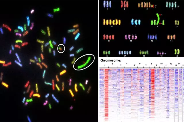 מחקר מראה שדפוסי DNA יכולים לפתוח כיצד חילוף החומרים של גלוקוז מניע סרטן