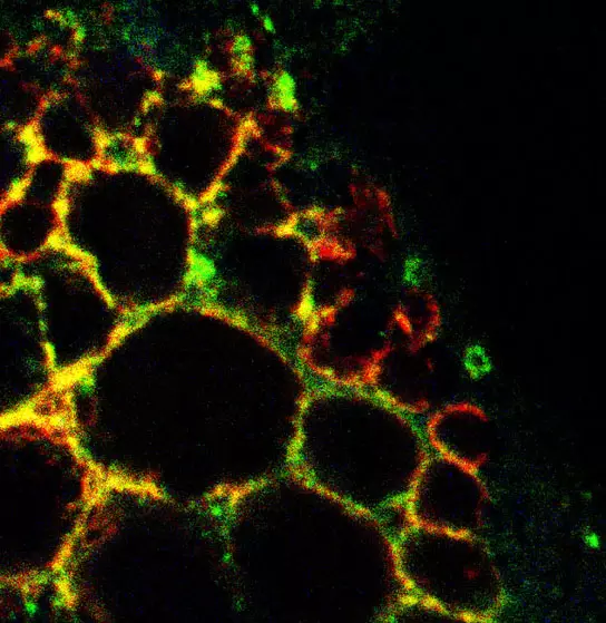 માઈક્રોસ્કોપ ઈમેજ માઉસના ચામડીના કોષની અંદર ઘણા વિસ્તૃત લિસોસોમ દર્શાવે છે