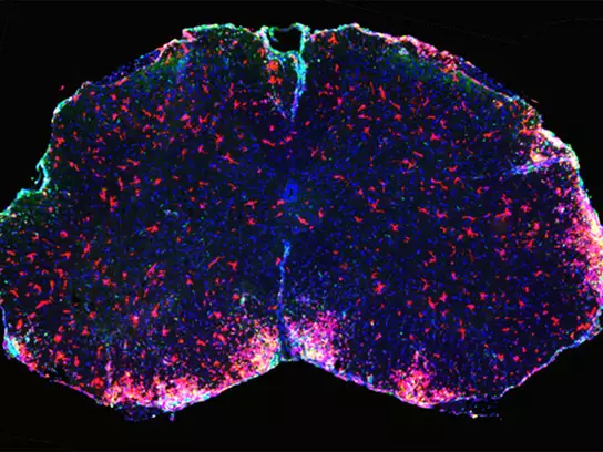 Des chercheurs découvrent le mode d'action d'un nouveau médicament contre la sclérose en plaques, le fumarate de diméthyle