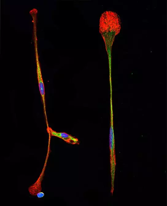 O anticorpo transforma as células nai da medula ósea directamente en células cerebrais